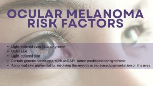 Ocular Melanoma Risk Factors - AIM at Melanoma Foundation