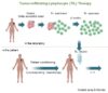 In Plain English: Tumor-Infiltrating Lymphocyte (“TIL”) Therapy for ...
