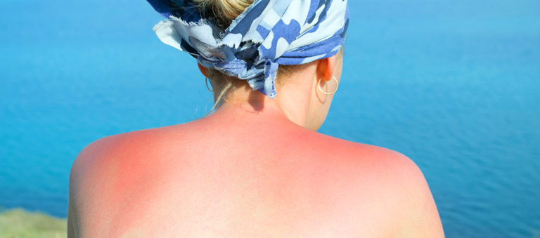 Outdoor Tanning - AIM at Melanoma Foundation