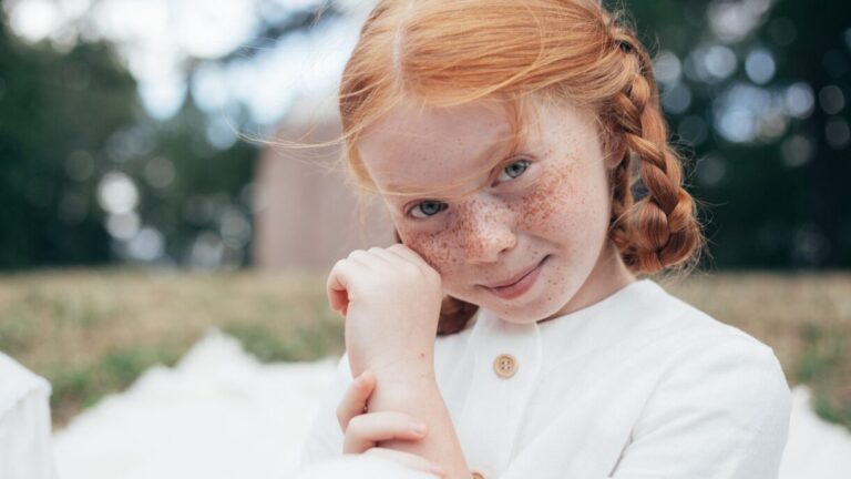 Red Hair Genetics: 5 Things You May Not Know - AIM at Melanoma Foundation